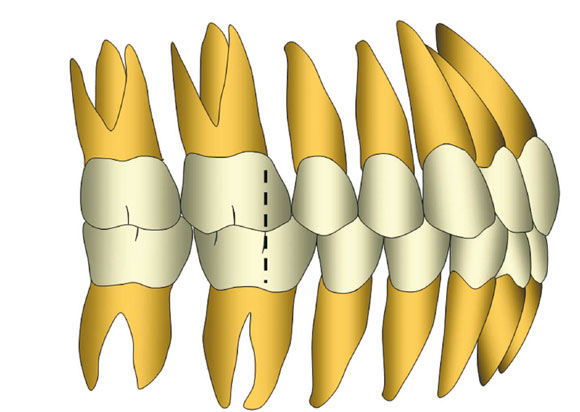 angle – Odonto Up